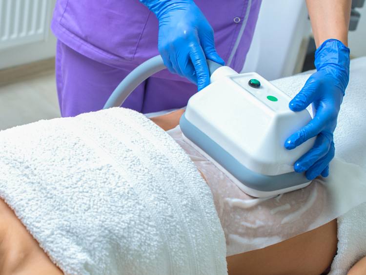 What is Cryolipolysis? Procedure, Benefits and Contraindications